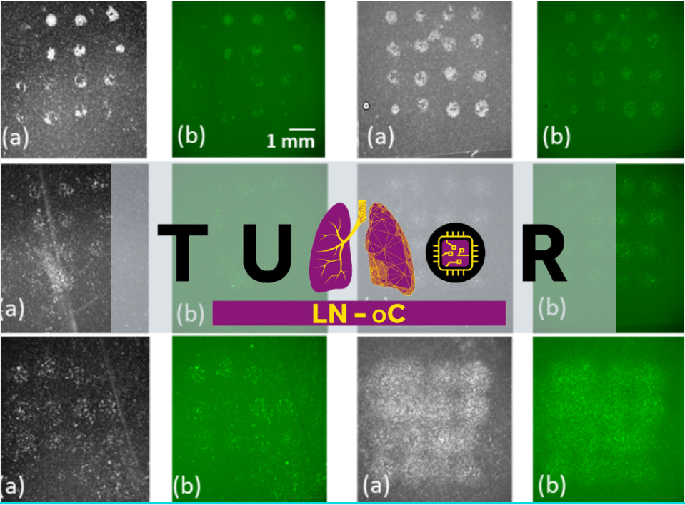 Laser bioprinting: a key technology for recapitulating tissue and cell ...